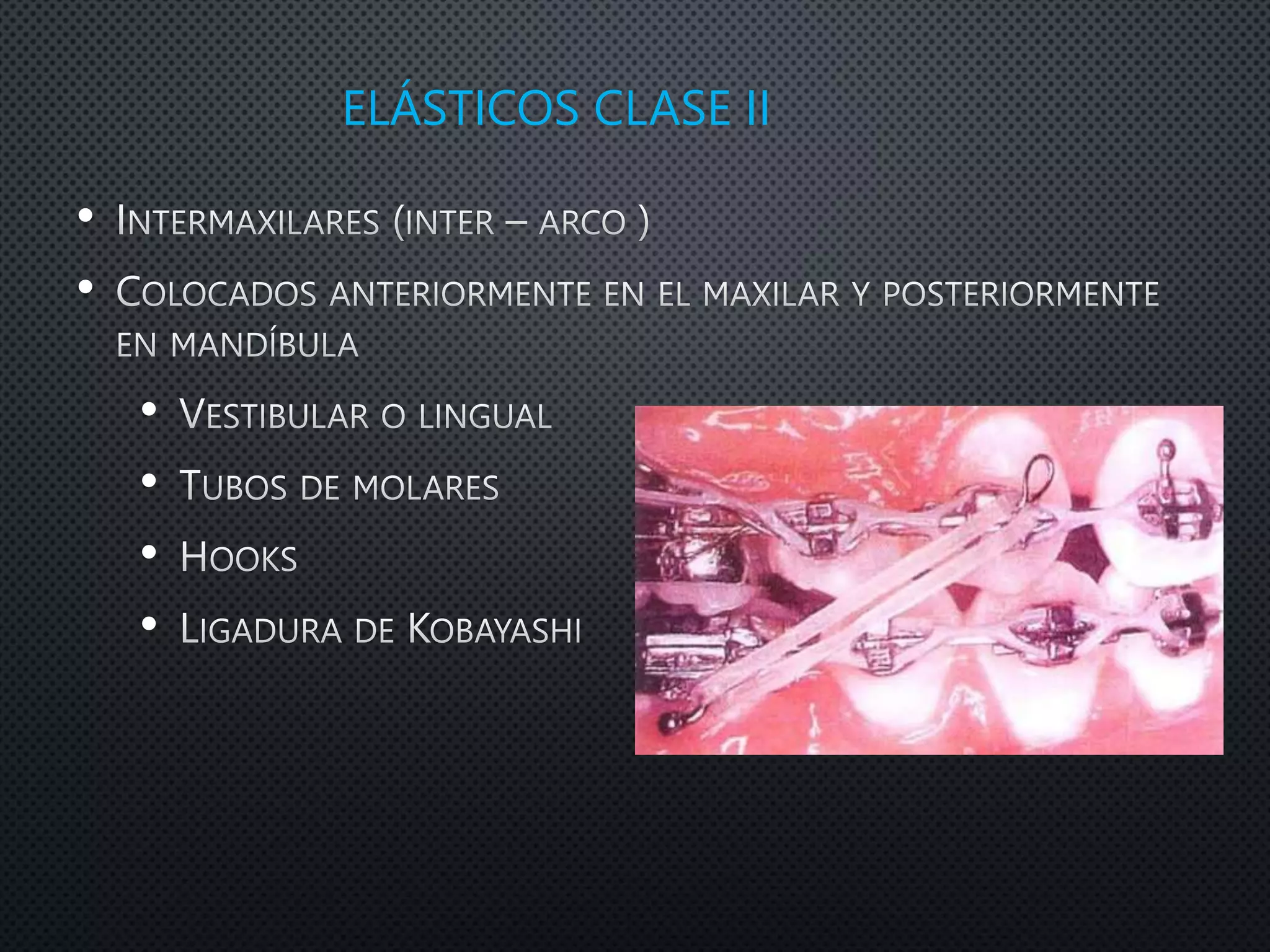 ELASTICOS INTERMAXILARES.pptx