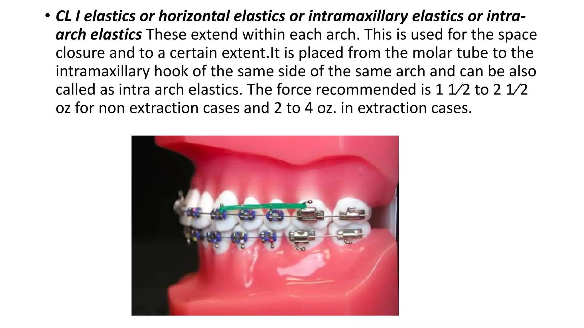 Elastics in Orthodontics -part I | PPTX