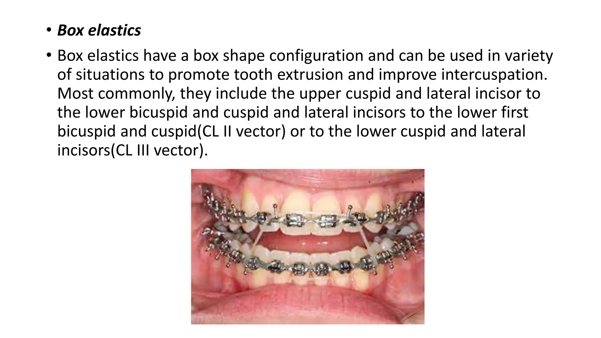 Elastics in Orthodontics -part I | PPTX