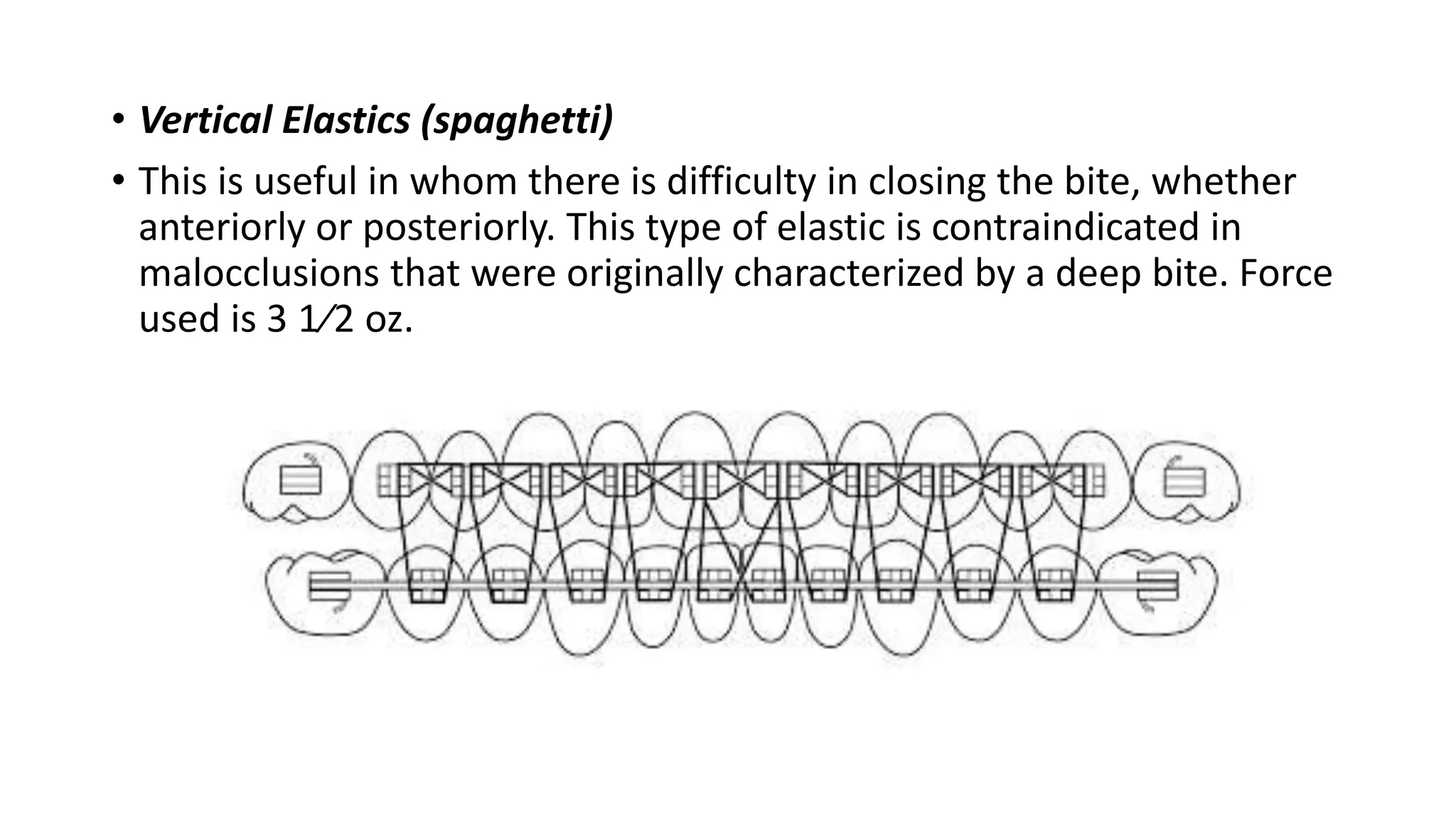Elastics in Orthodontics -part I | PPTX