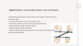 Comprehensive Overview of Orthodontic Elastics: Types, Uses, and ...