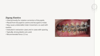 Comprehensive Overview of Orthodontic Elastics: Types, Uses, and ...