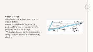 Comprehensive Overview of Orthodontic Elastics: Types, Uses, and ...