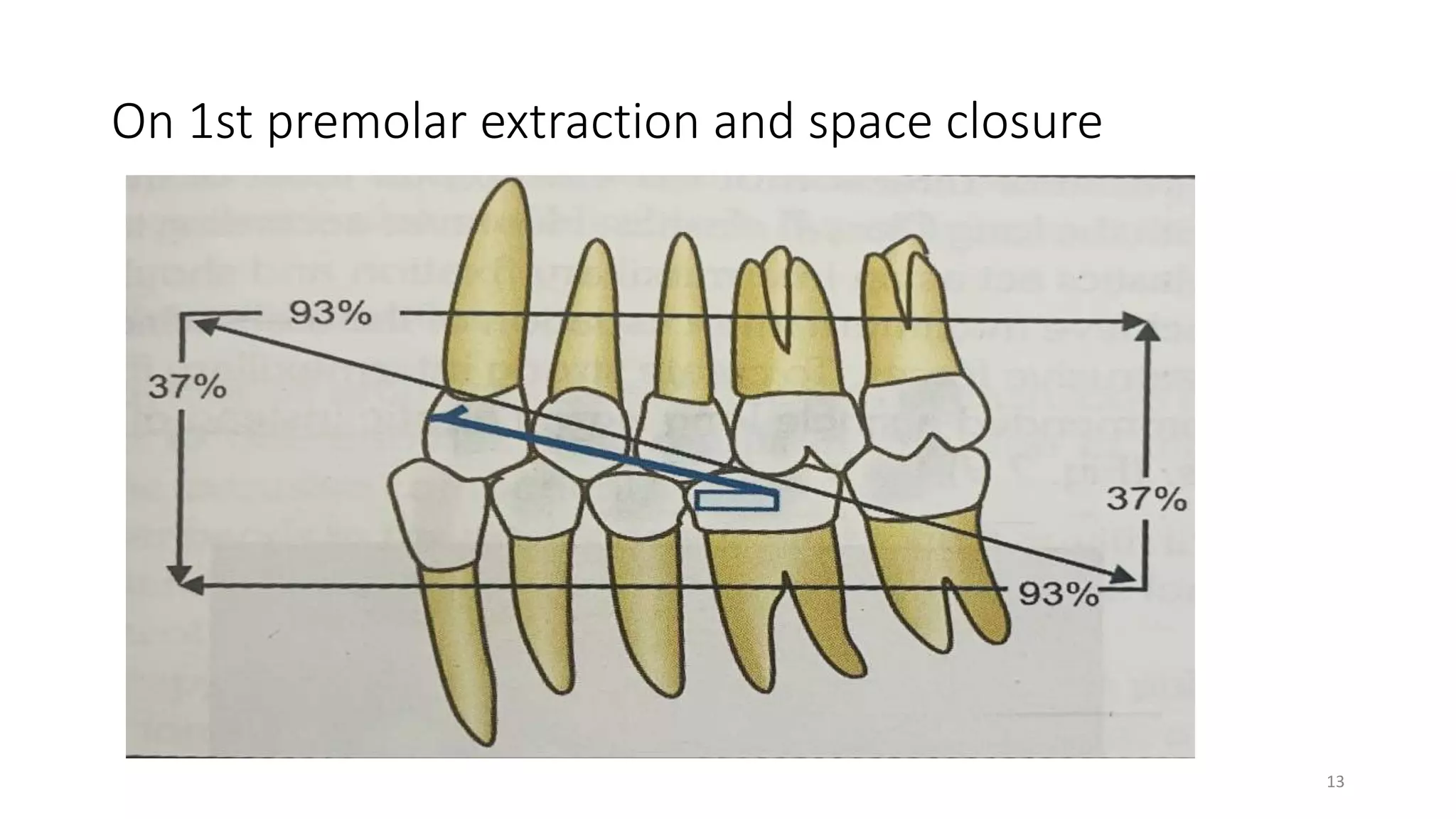 Elastics in Orthodontics-II | PPTX