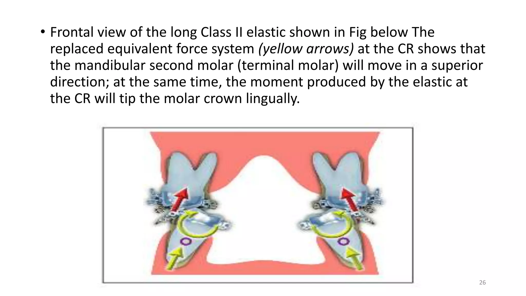 Elastics in Orthodontics-II | PPTX