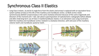 Elastics in Orthodontics-II | PPTX