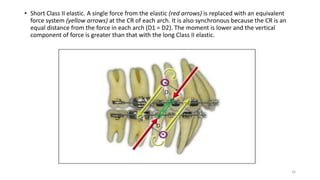 Elastics in Orthodontics-II | PPTX