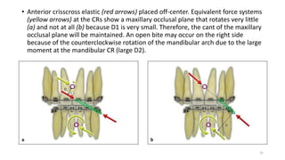 Elastics in Orthodontics-II | PPTX
