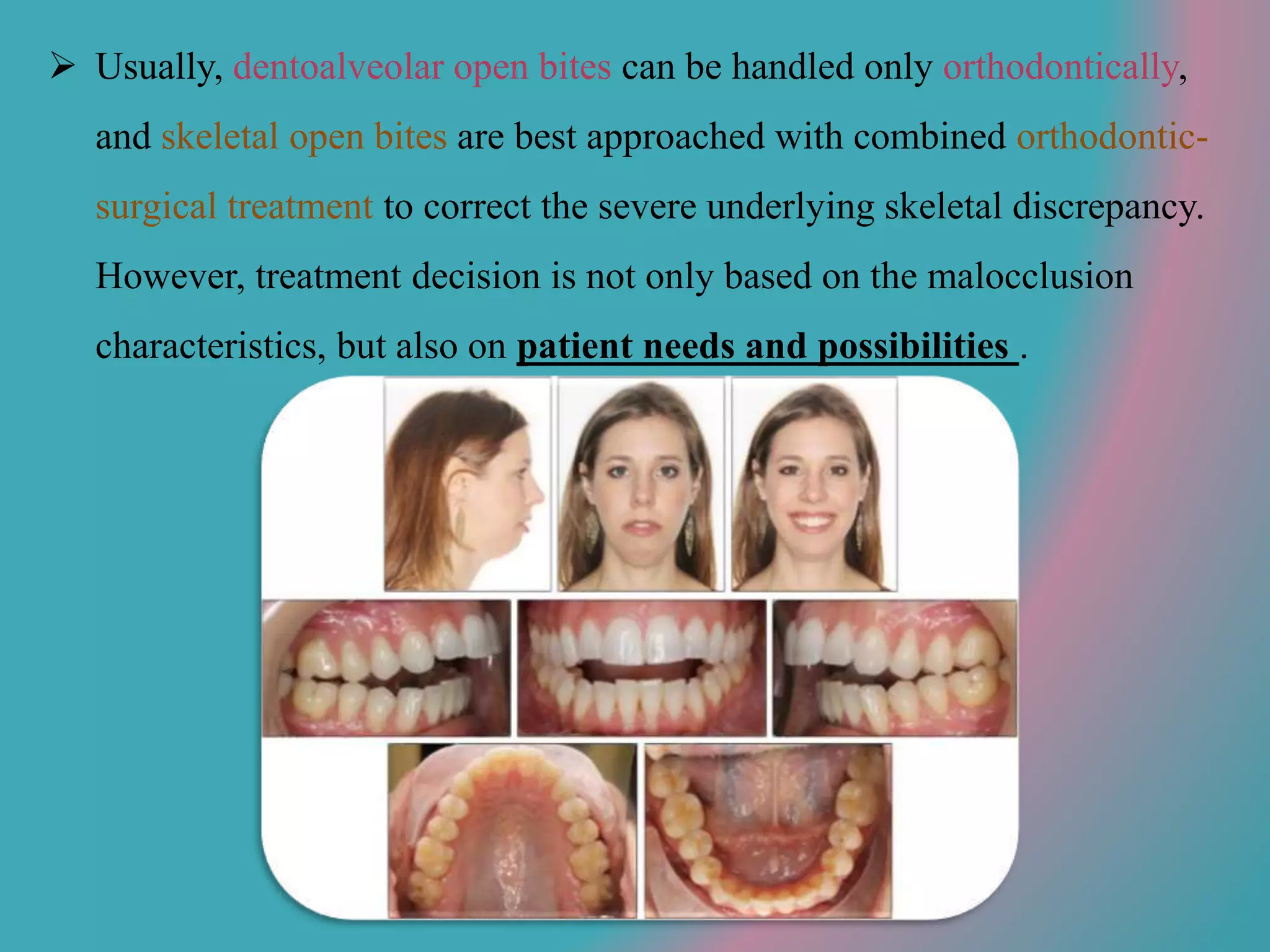 Elastics for open bite treatment | PPTX