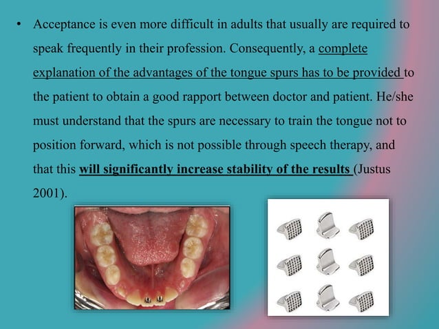 Elastics for open bite treatment | PPTX