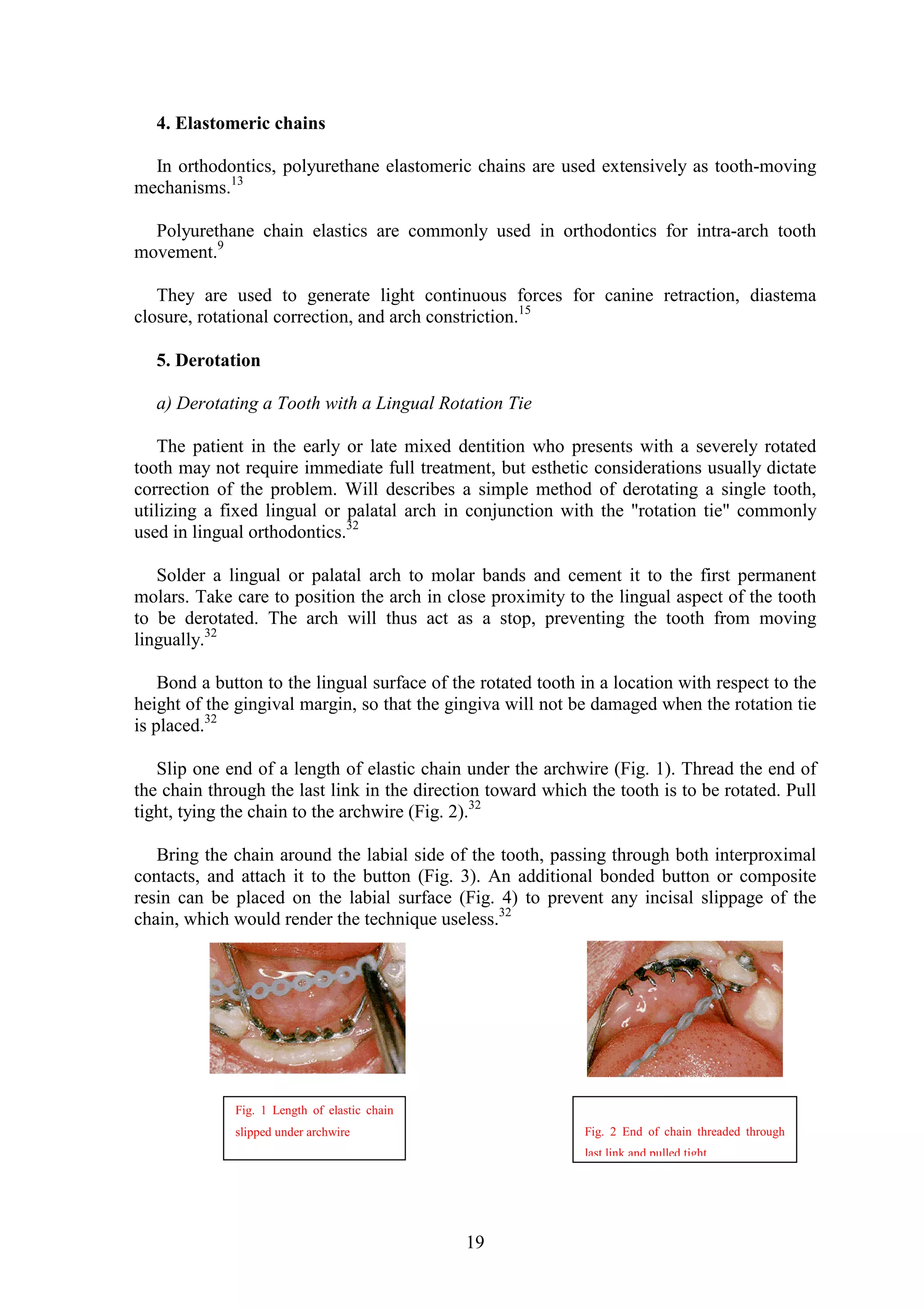 Elastics in orthodontics | PDF