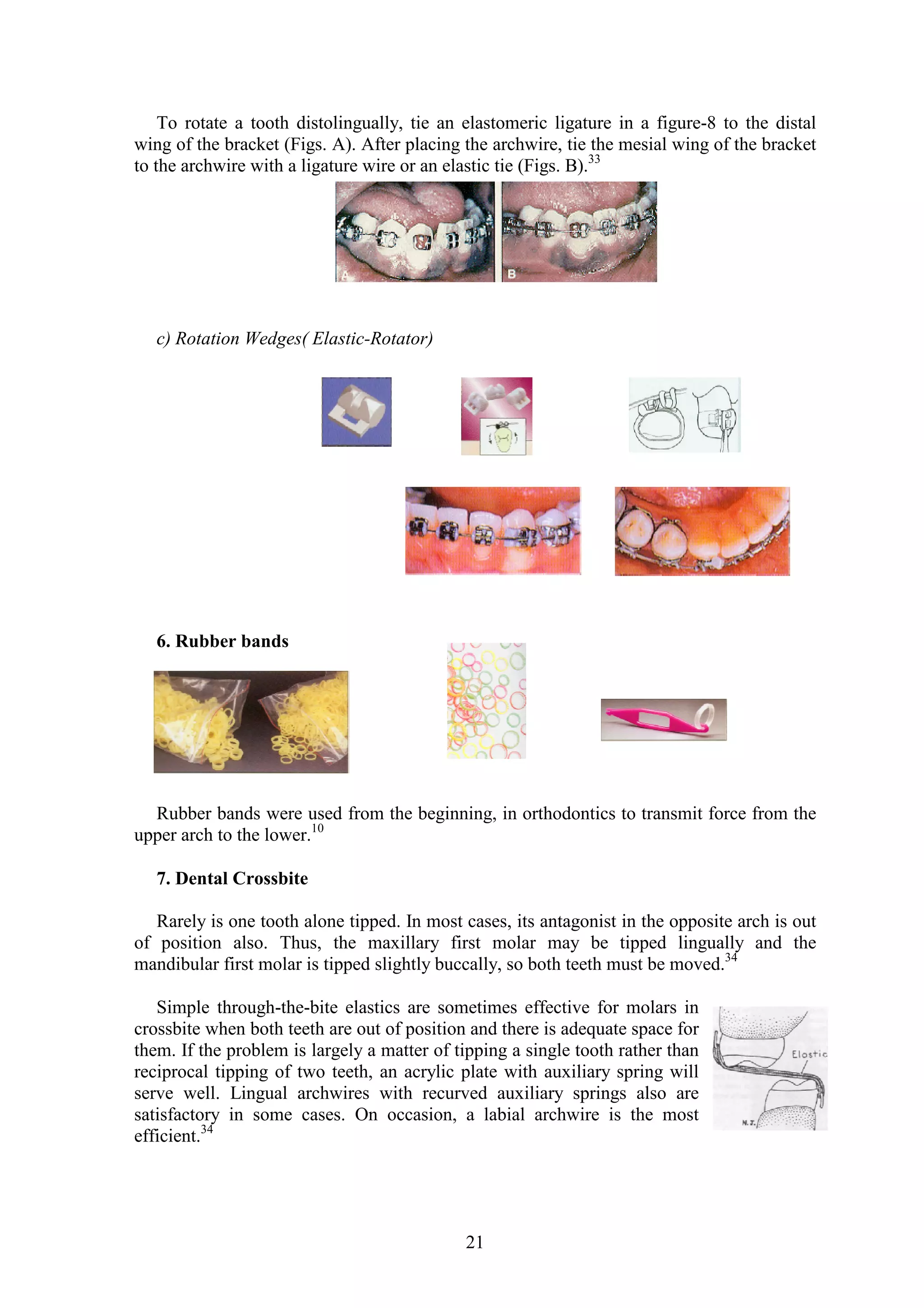 Elastics in orthodontics | PDF