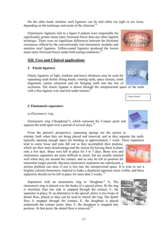 Elastics in orthodontics | PDF