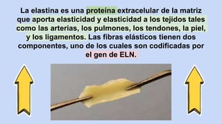 Elastina Y SUS CARACTERISTICAS BÁSICAS | PPTX