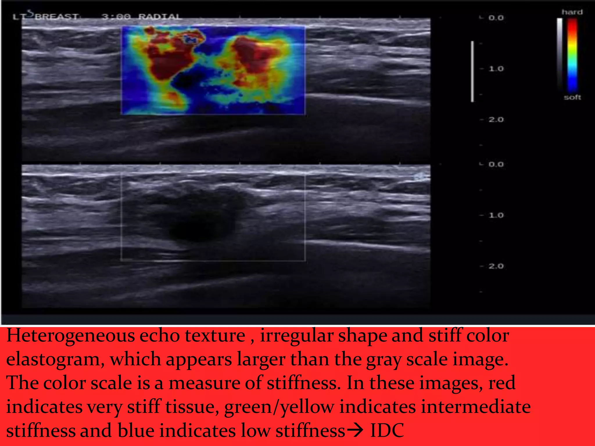 Elastography | PPTX