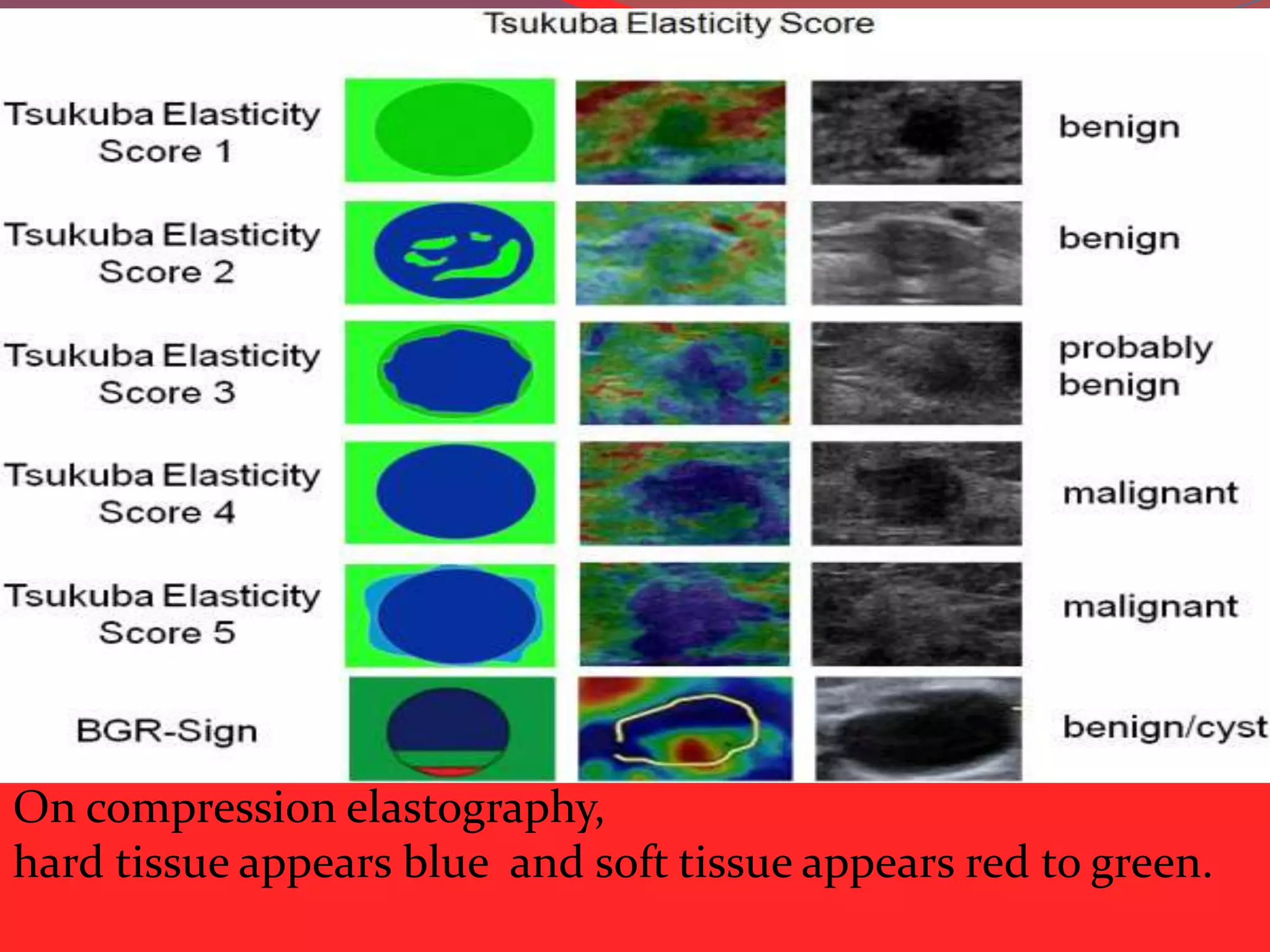 Elastography | PPTX