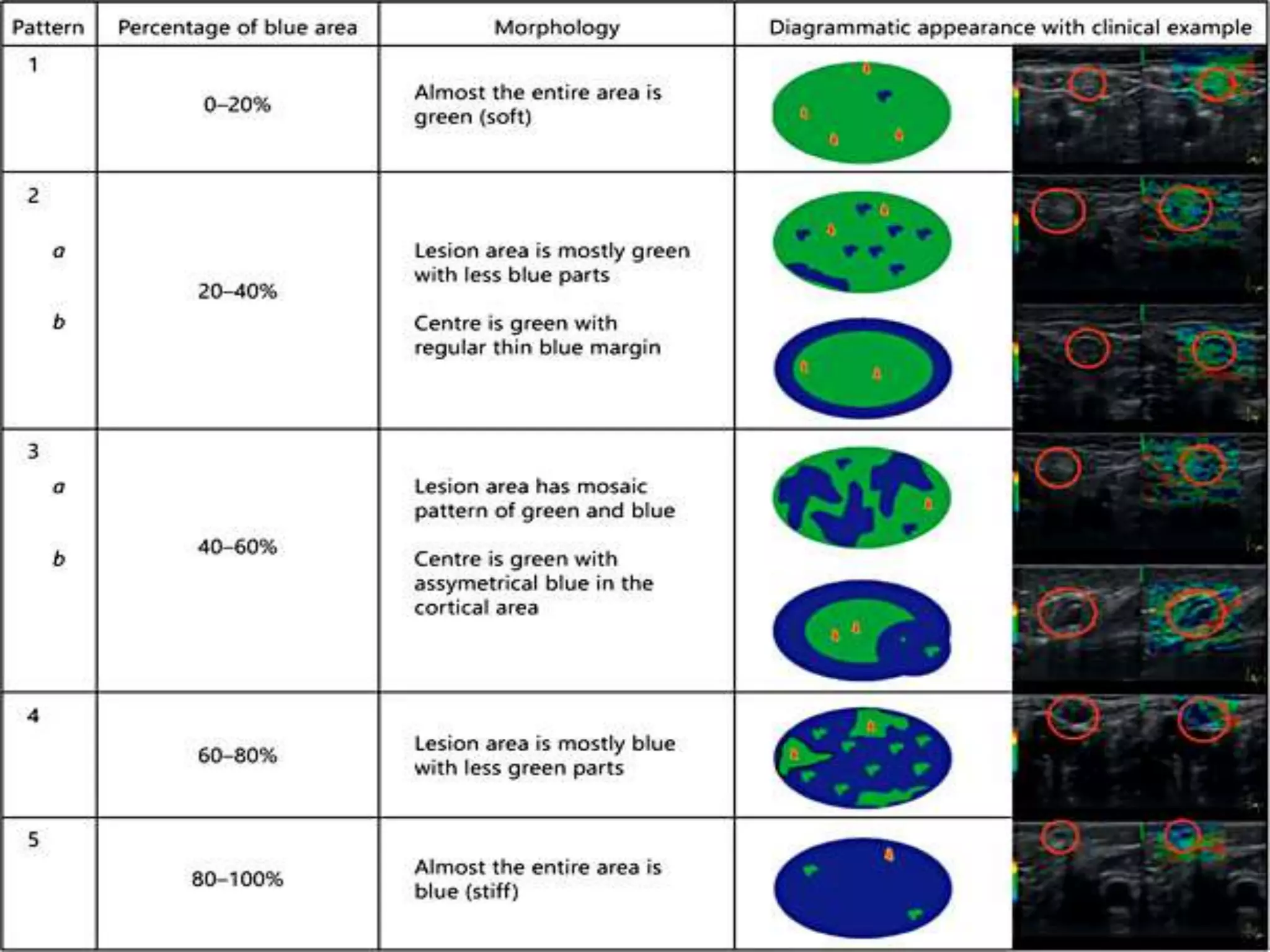 Elastography | PPTX