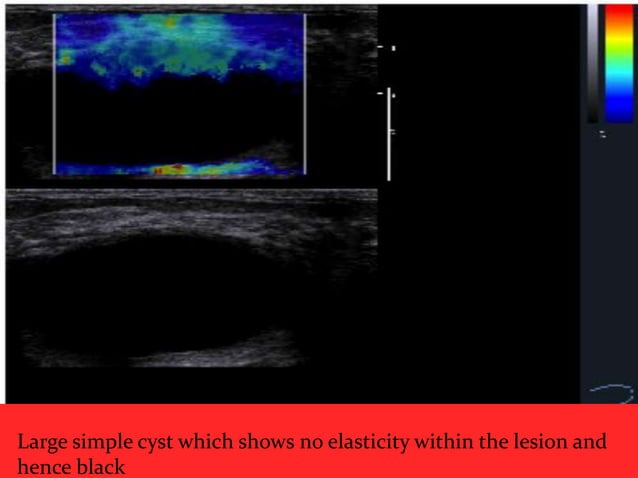Elastography | PPTX | Physics | Science