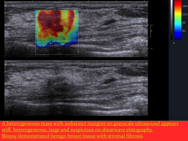 Elastography | PPTX | Physics | Science
