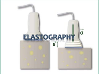 Elastography | PPTX