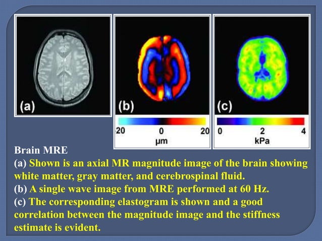 MR Elastography | PPTX | Medical Tests | Medical Health