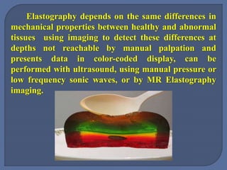 MR Elastography | PPTX