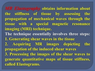 MR Elastography | PPTX
