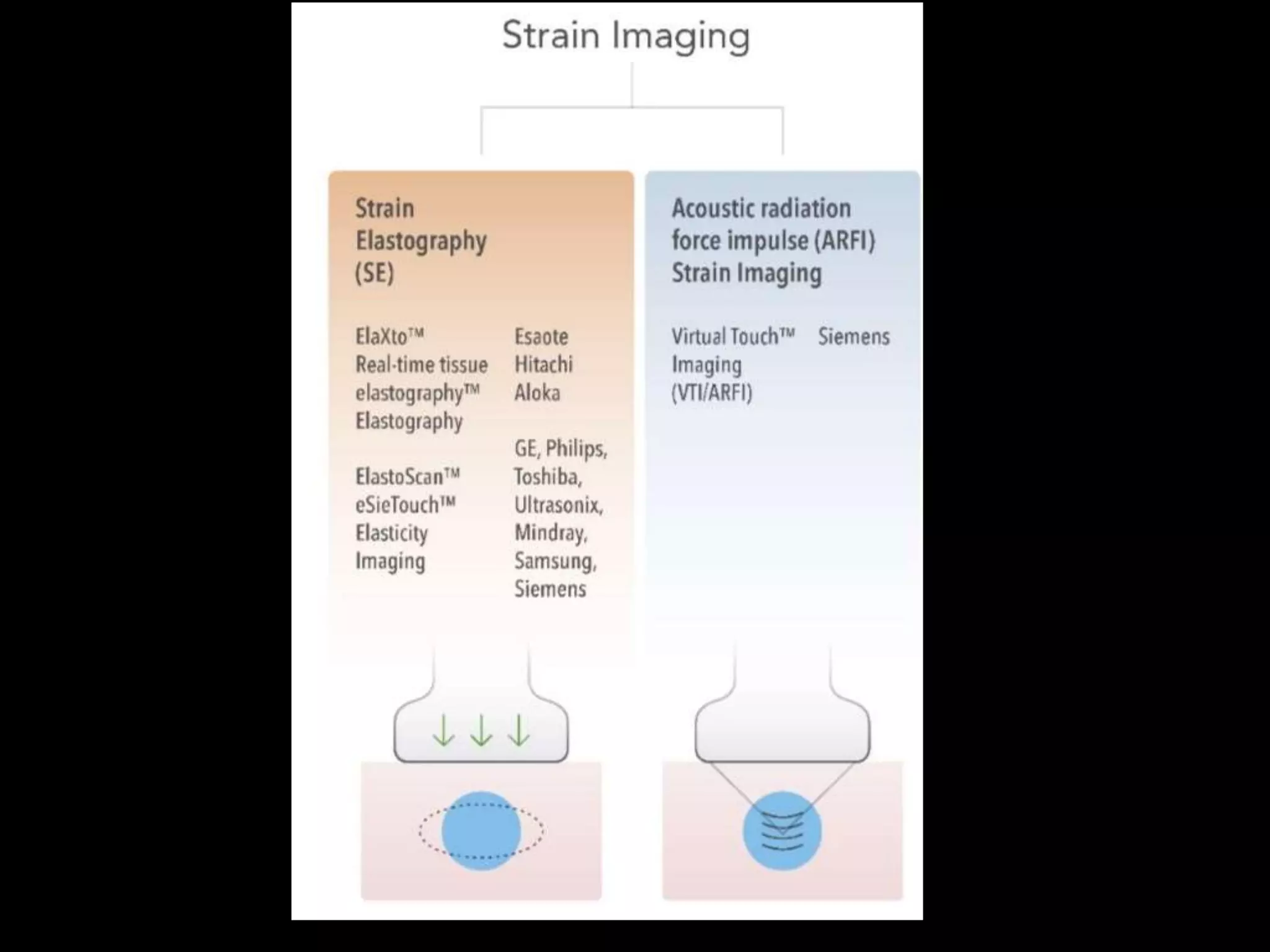 Shear wave Elastography of Liver | PPTX