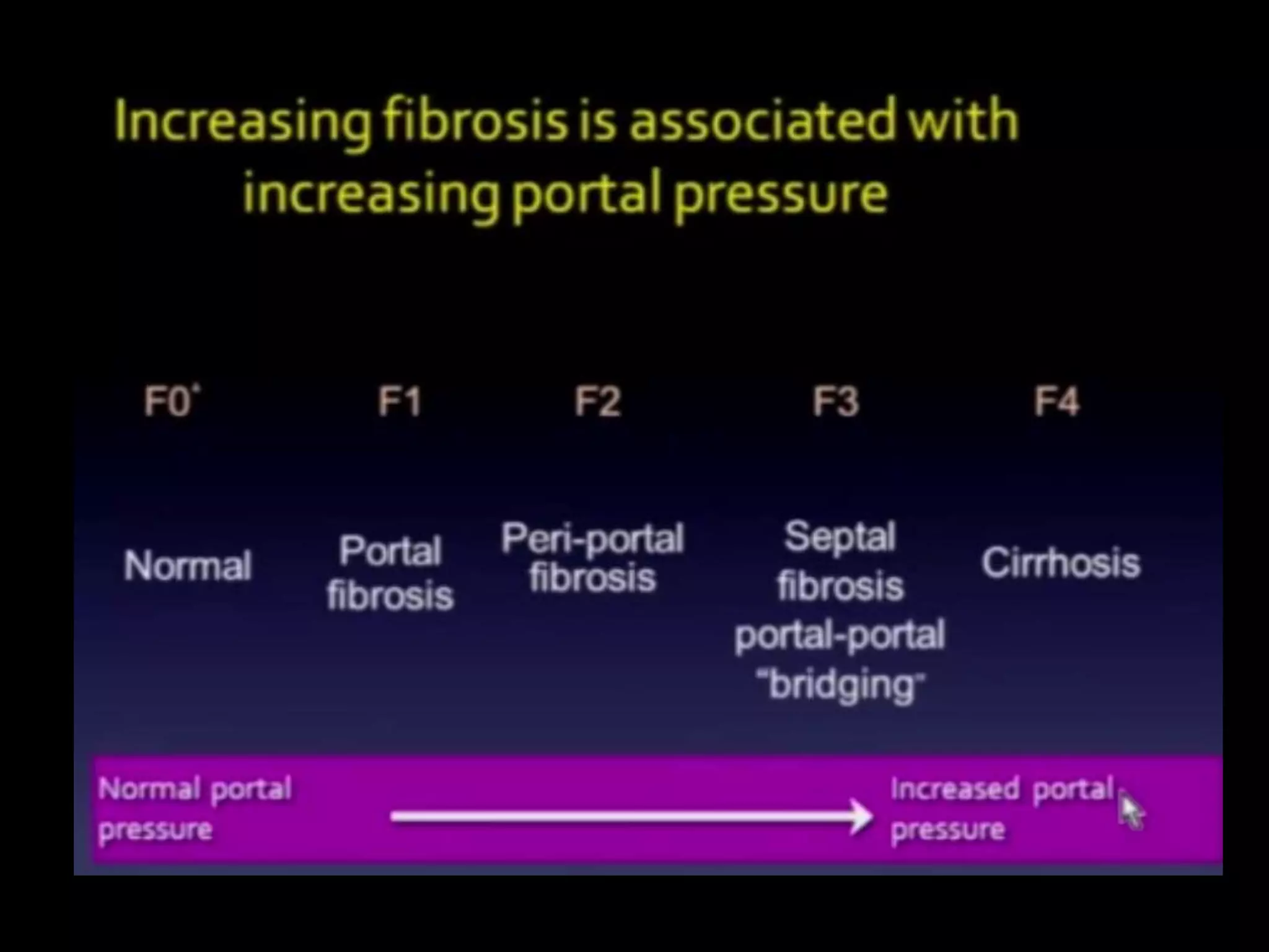 Liver Fibrosis - SWE and MRE | PPTX | Blood Disorders | Diseases and ...