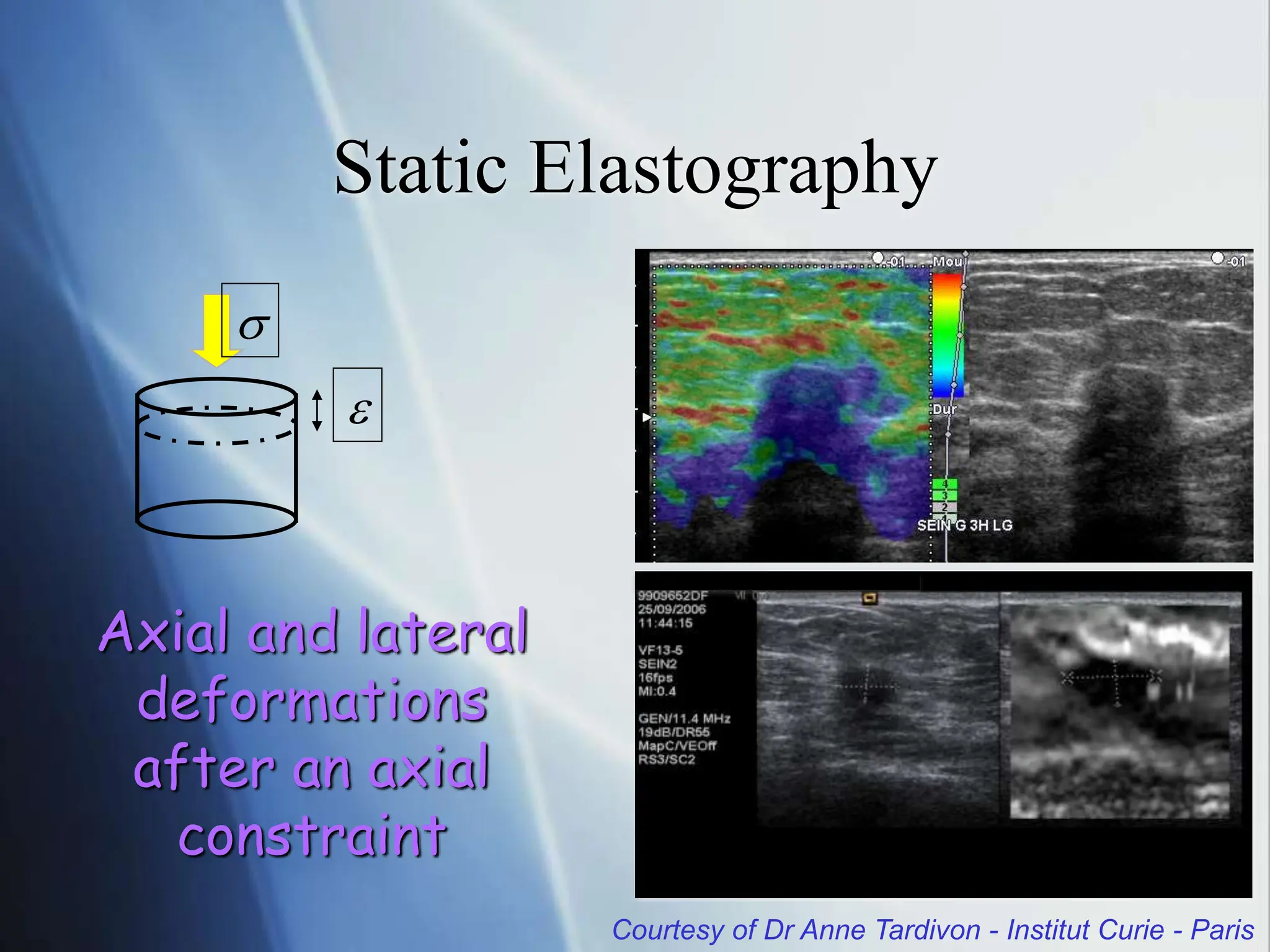 Elastography overview, modality, adavancement | PPT