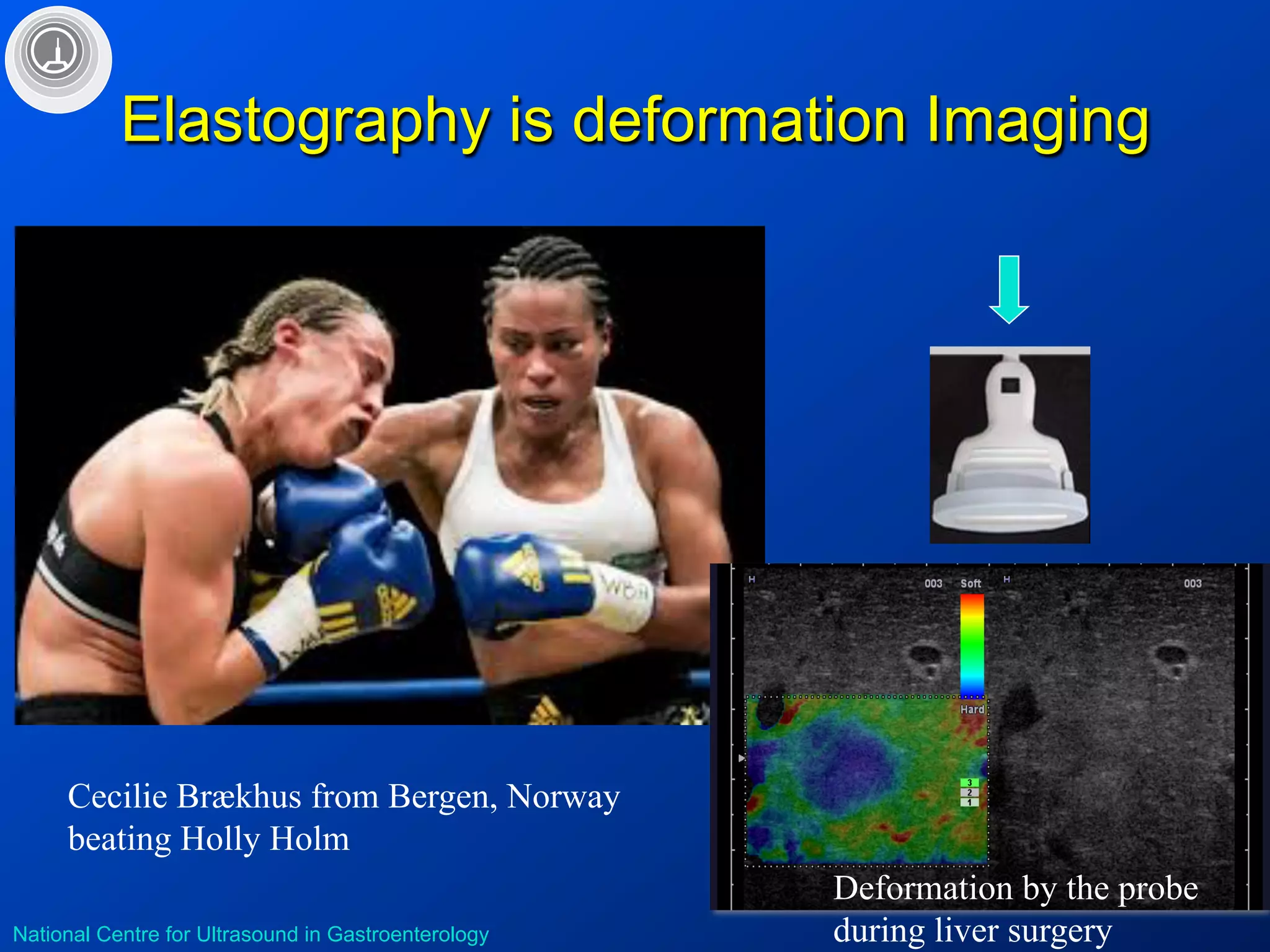 Elastography and ceus gilja | PPT