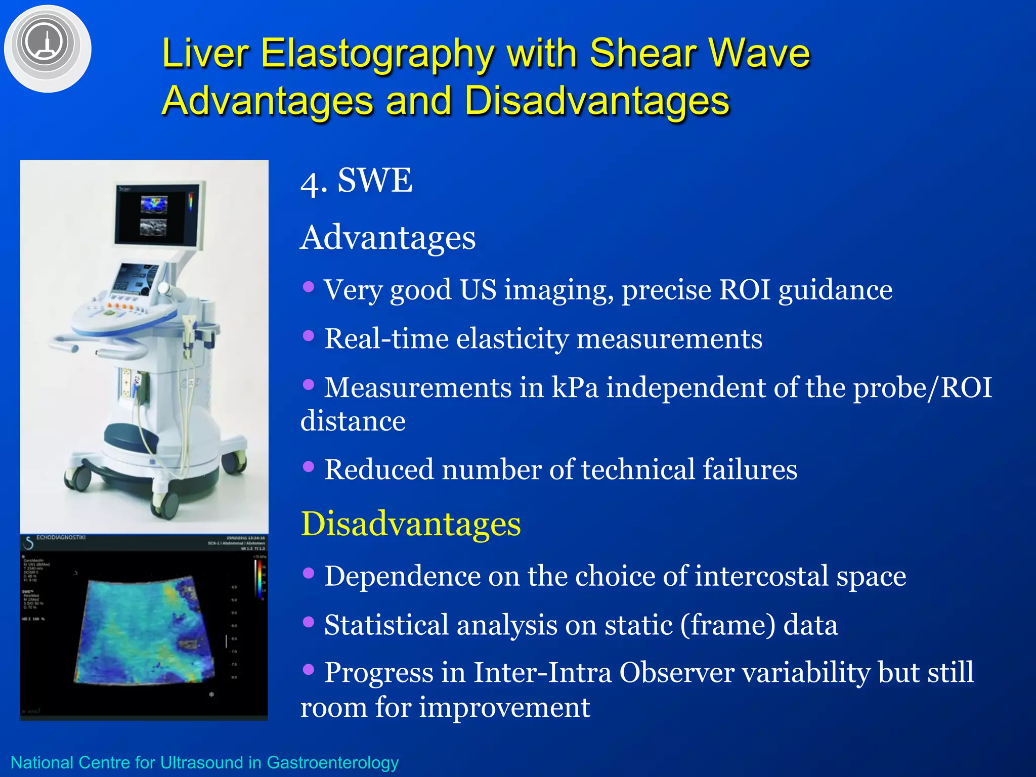 Elastography and ceus gilja | PPT