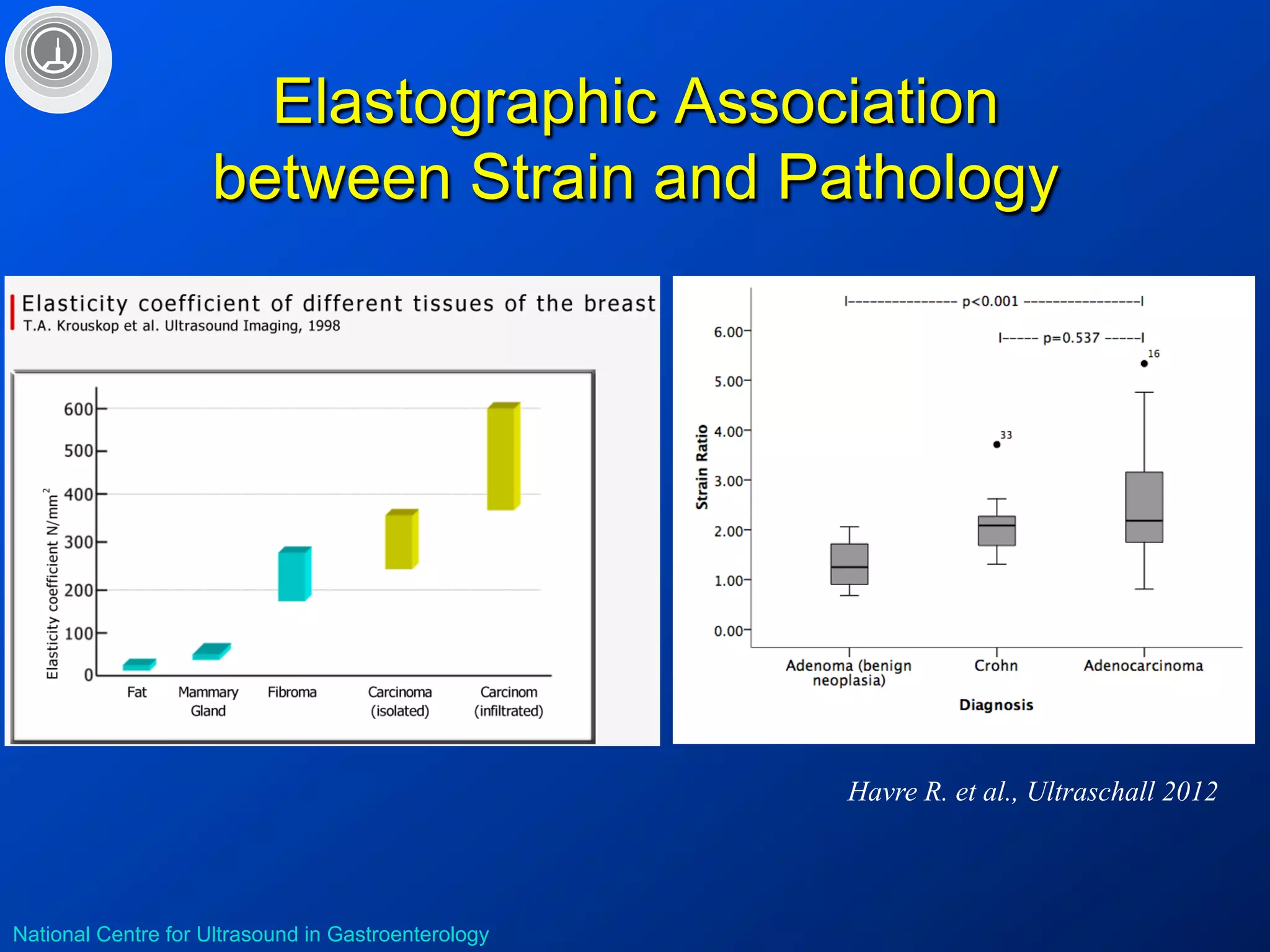 Elastography and ceus gilja | PPT