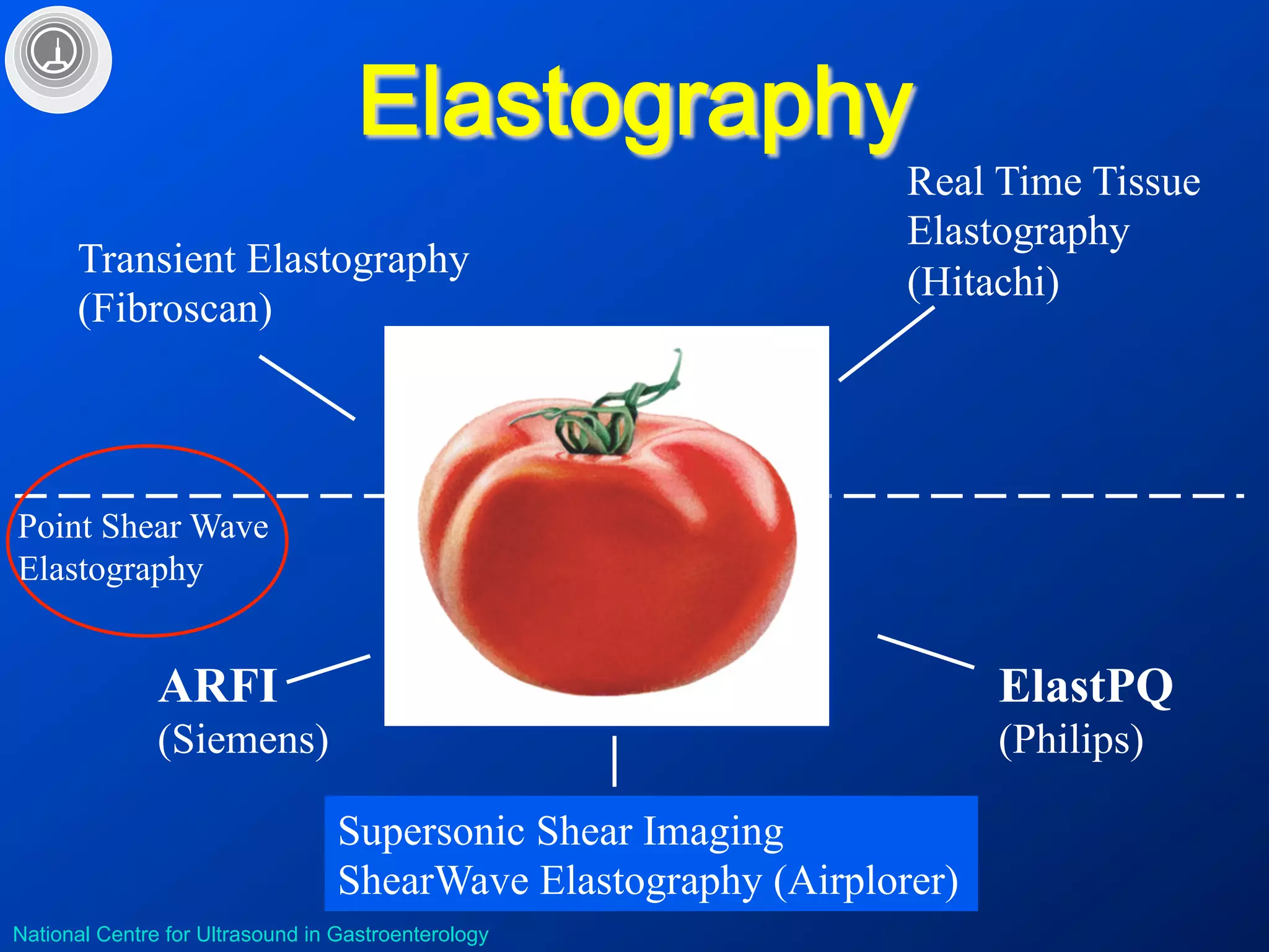 Elastography and ceus gilja | PPT