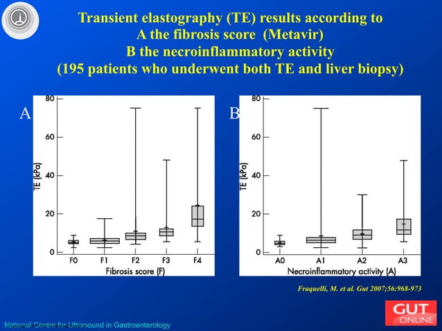 Elastography and ceus gilja | PPT