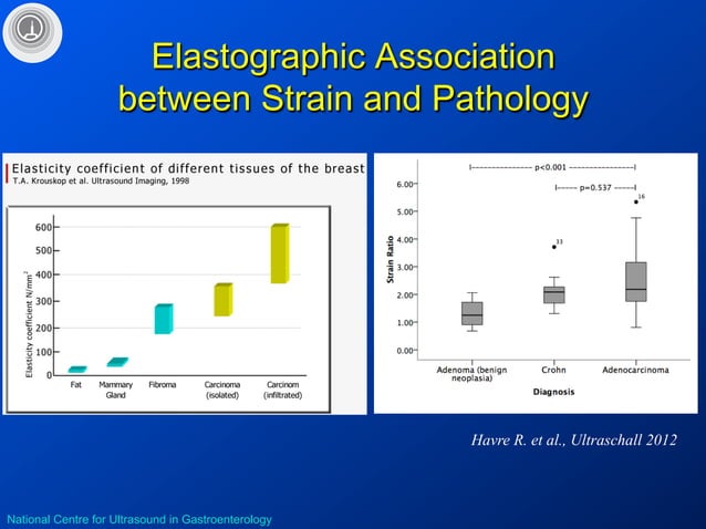 Elastography and ceus gilja | PPT