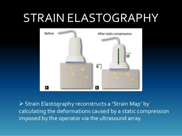 Ultrasound Elastography