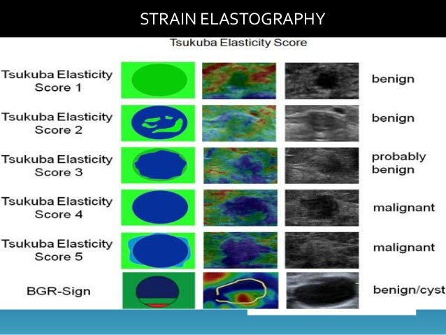 Ultrasound Elastography