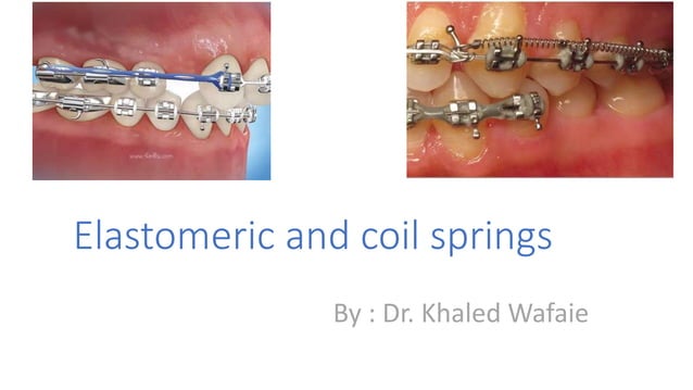 Elastomeric and coil springs | PPTX | Oral care | Personal Care