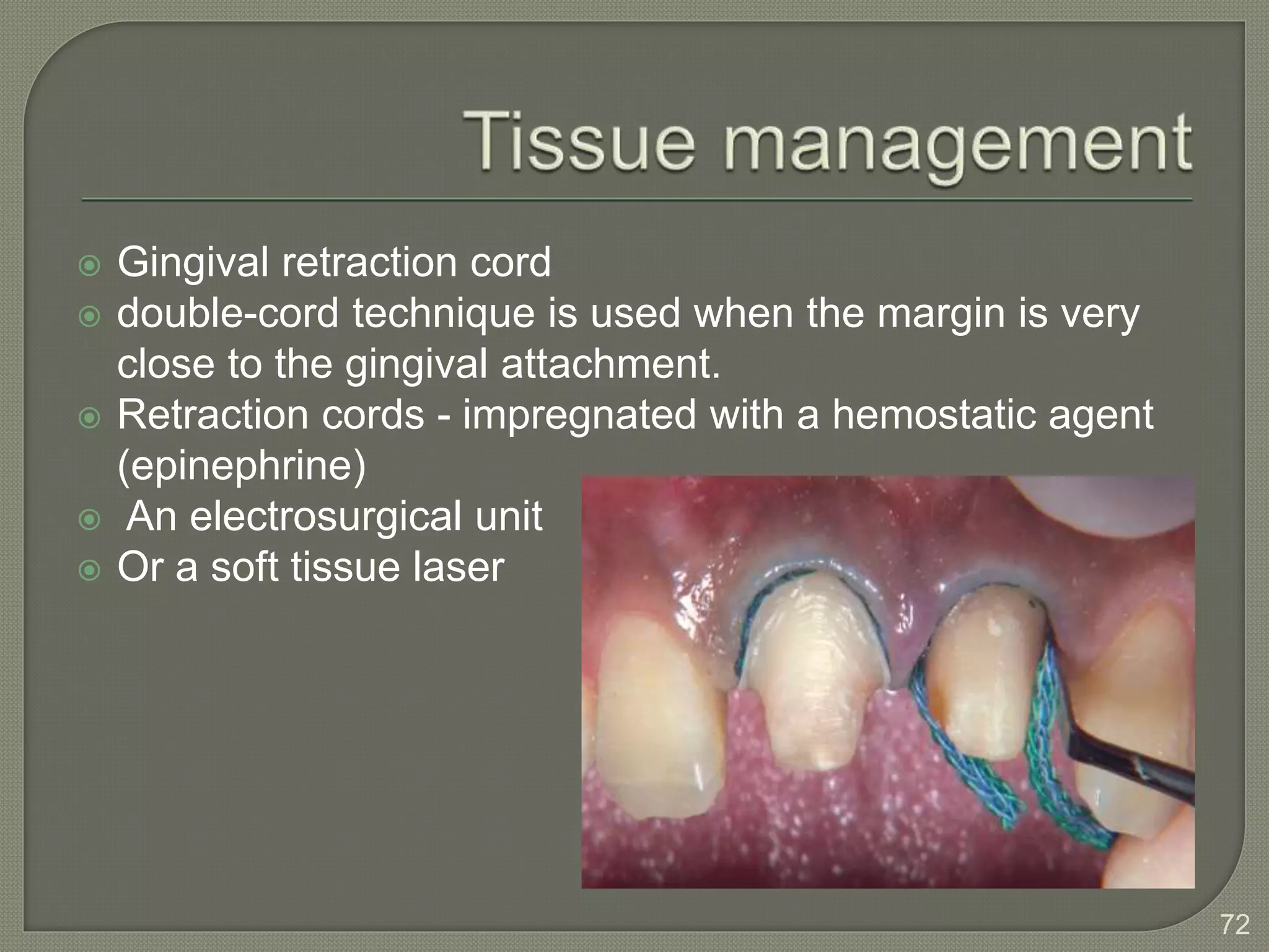 Elastomeric impression materials | PPTX