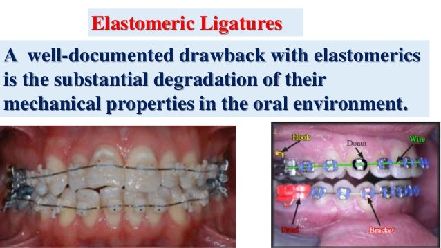 Elastomeric ligatures final. Prof. maher fouda