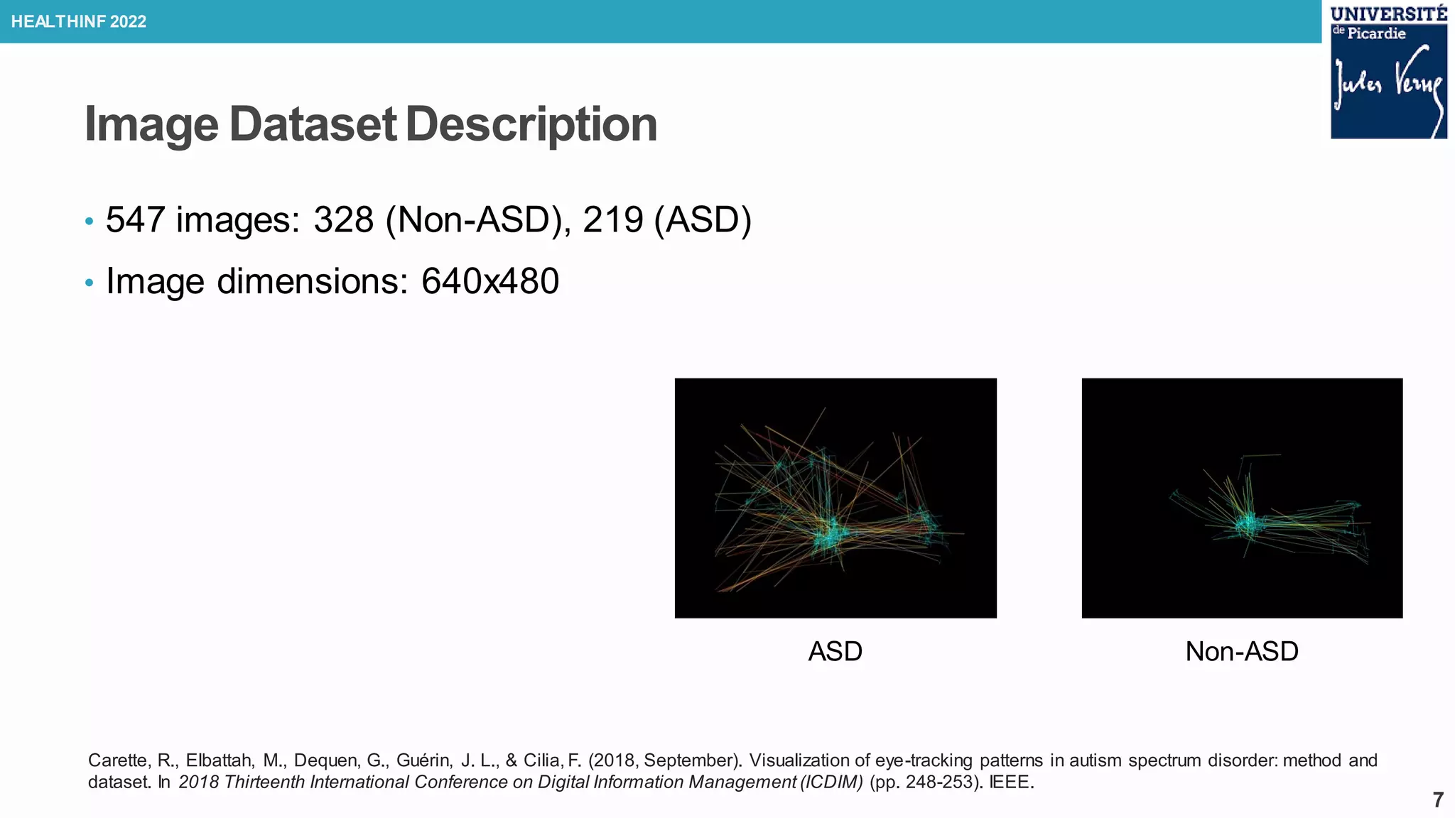 Vision-Based Approach for Autism Diagnosis Using Transfer Learning and ...
