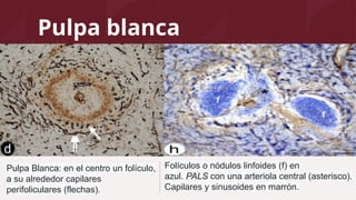 EL BAZO COMO INERVACION Y SUS DIFERENCIAS | PPT