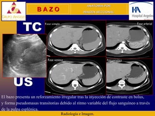 El Bazo Cementerio De Leucocitos Y De Conocimientos RadiolóGicos. | PDF