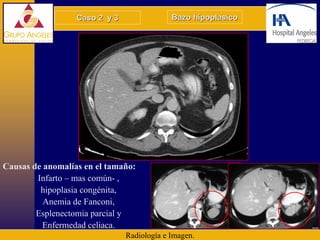 El Bazo Cementerio De Leucocitos Y De Conocimientos RadiolóGicos. | PDF