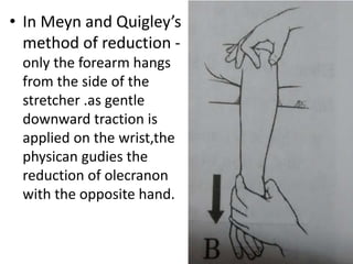 dislocations & fractures of Elbow in adults | PPTX