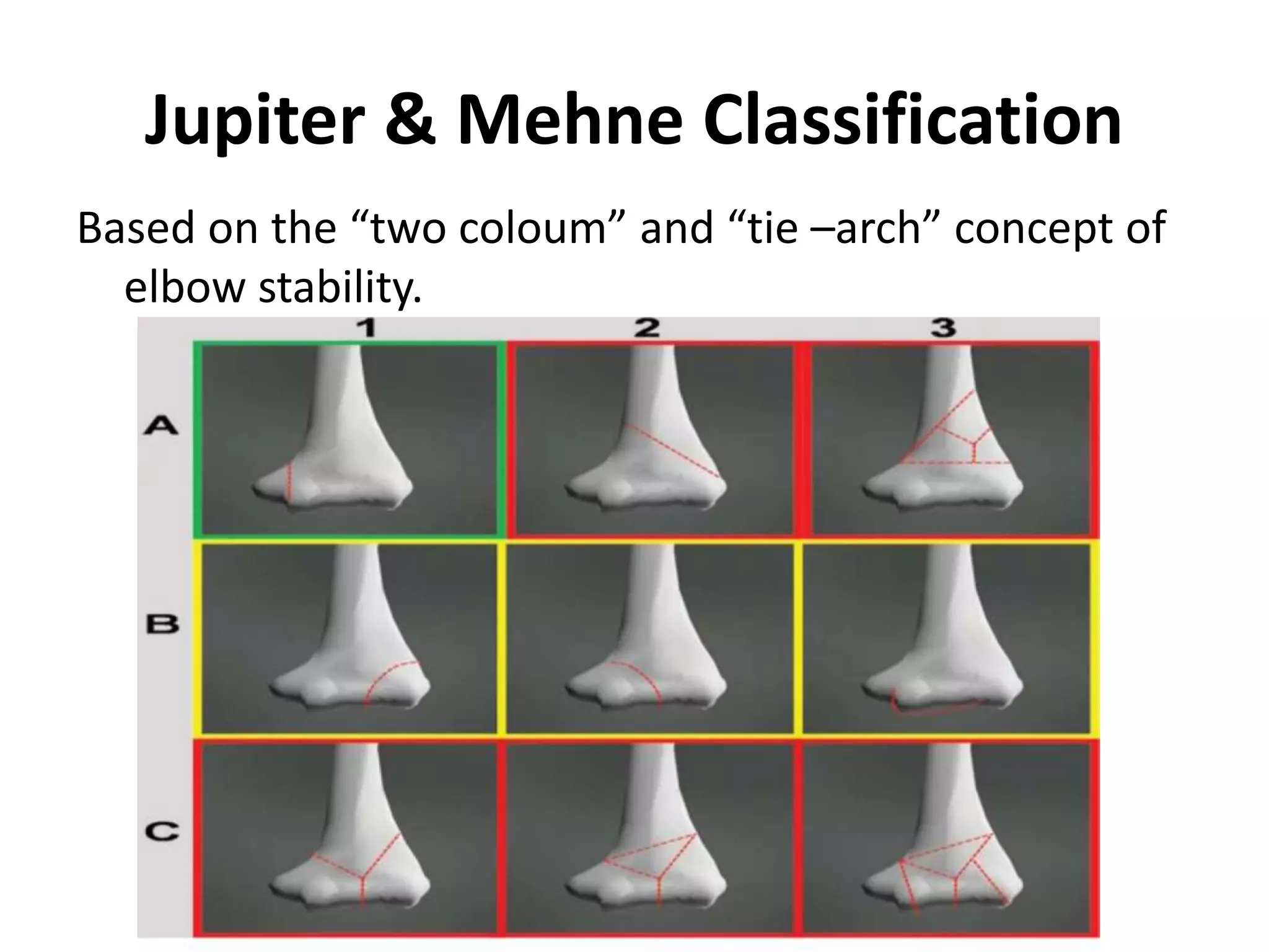 Elbow FRACTURE | PPTX