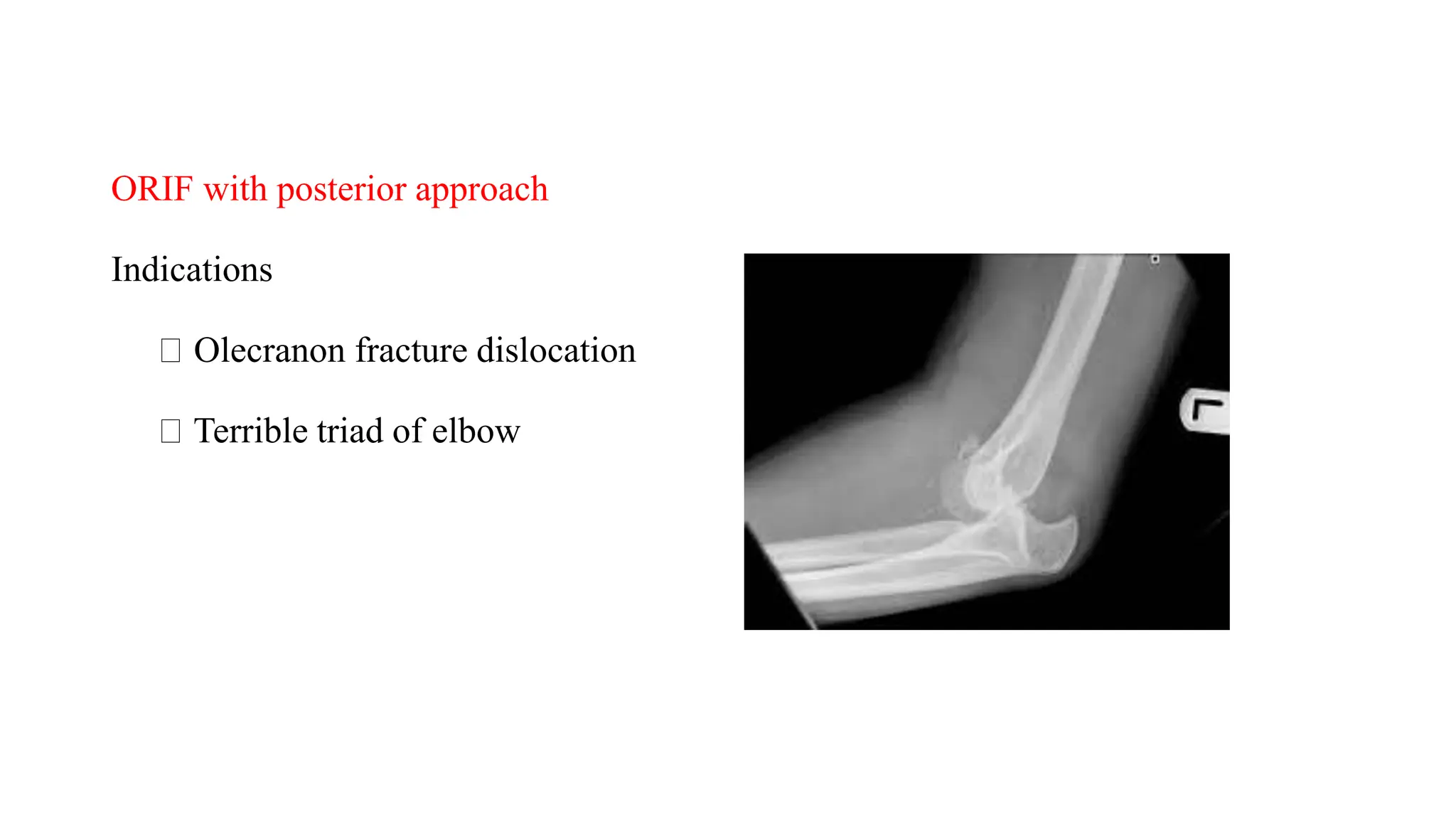Elbow Anatomy and biomechanic powerpoint .pptx