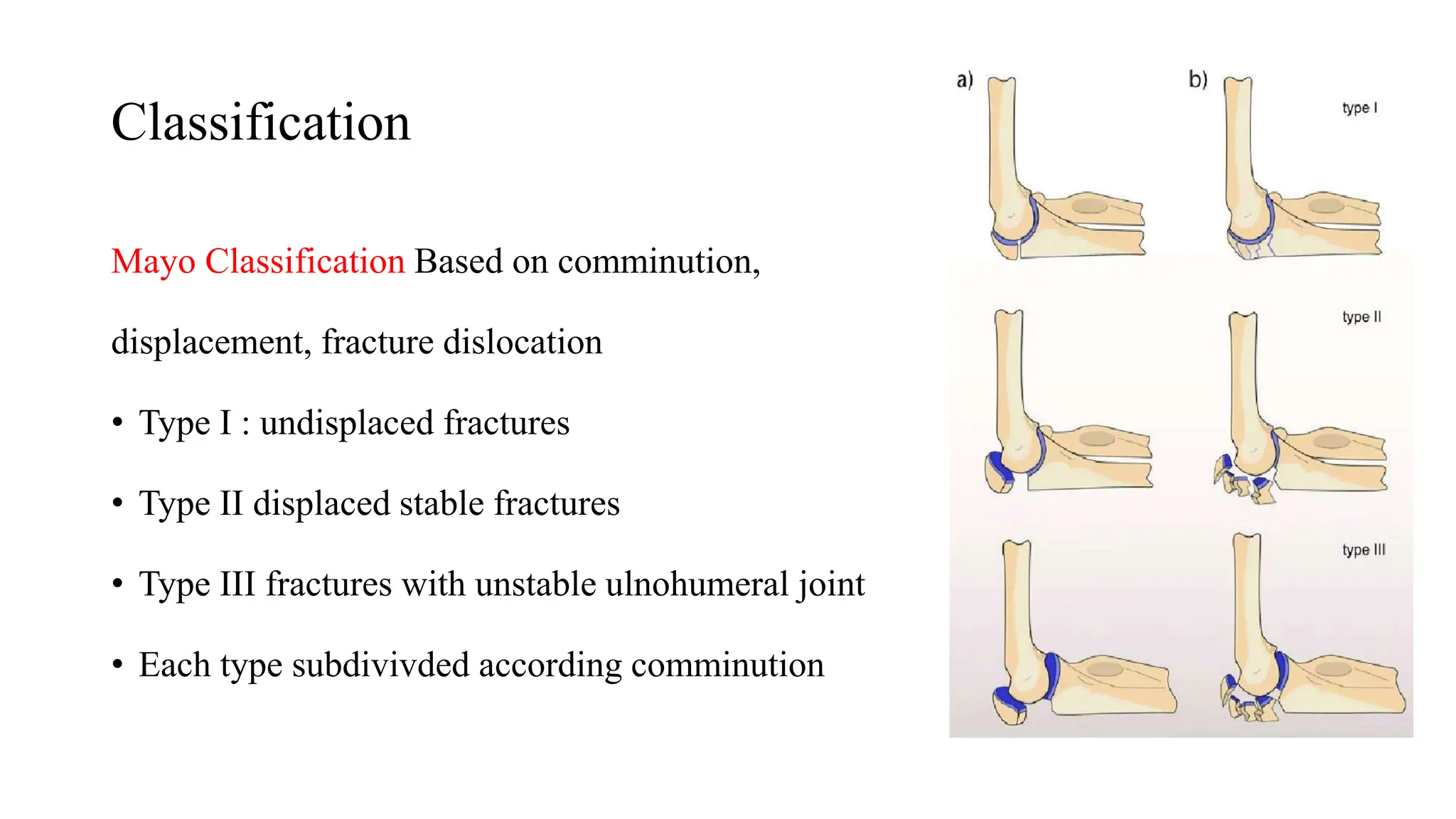 Elbow Anatomy and biomechanic powerpoint .pptx