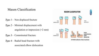 Elbow Anatomy and biomechanic powerpoint .pptx